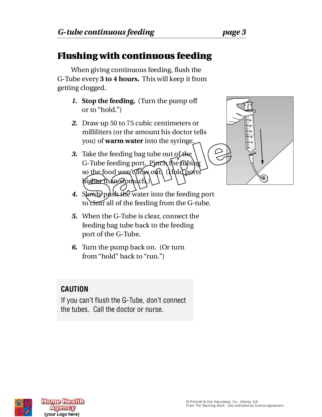 The Teaching Book Assisting Skills G-tube Continuous Feeding by ...