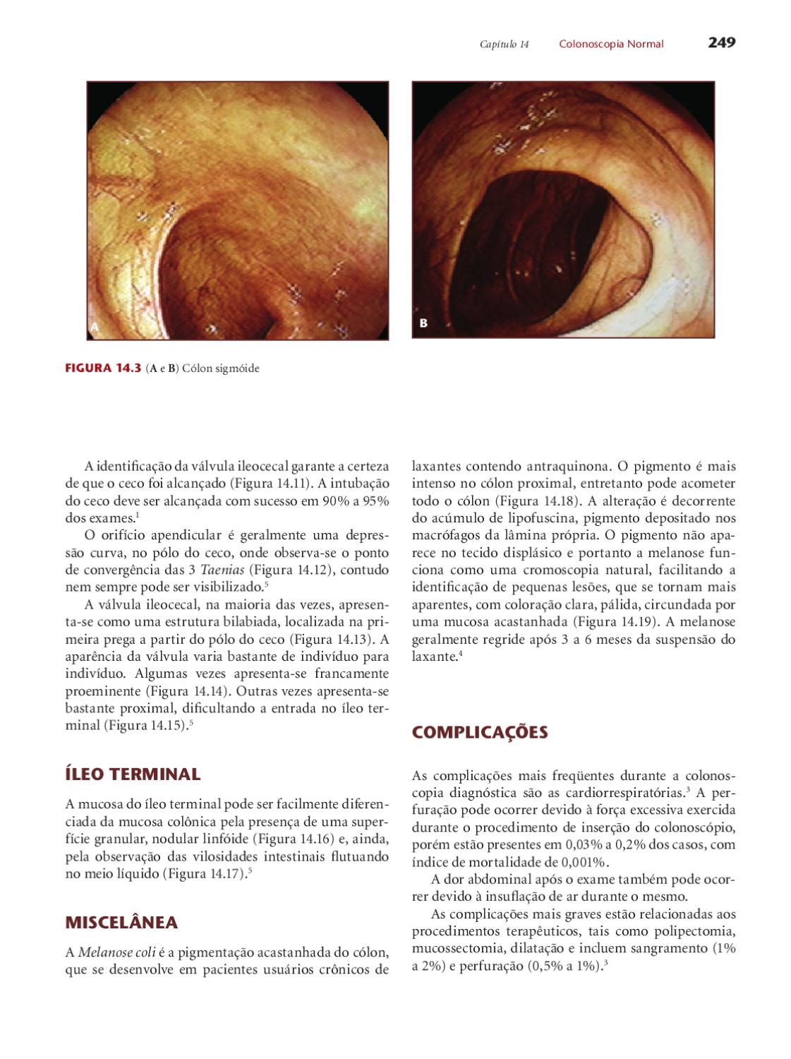 Atlas de Endoscopia Digestiva by Editora Rubio - Issuu