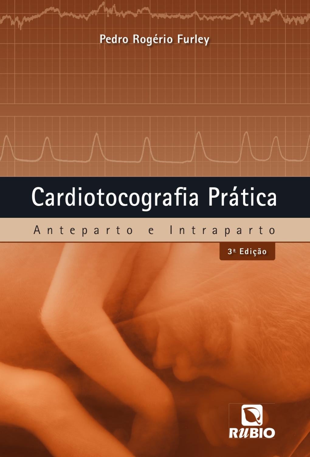 Cardiotocografia Prática - Anteparto e intraparto by Editora Rubio - Issuu