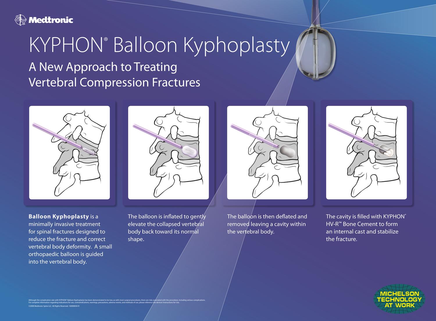 Kyphon Booth Panels by Chikamura Design - Issuu