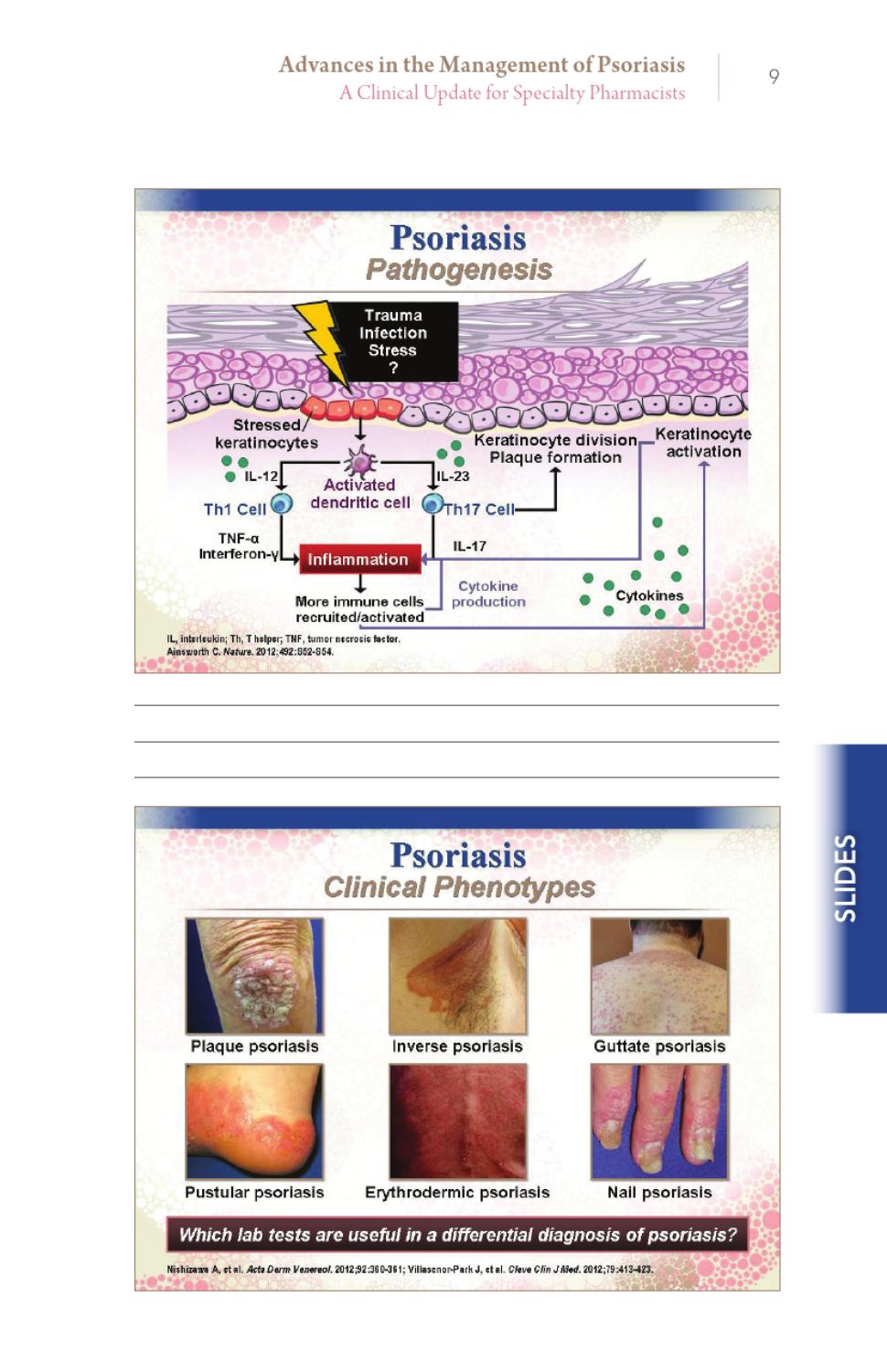 Advances in the Management of Psoriasis by Integritas Communications ...
