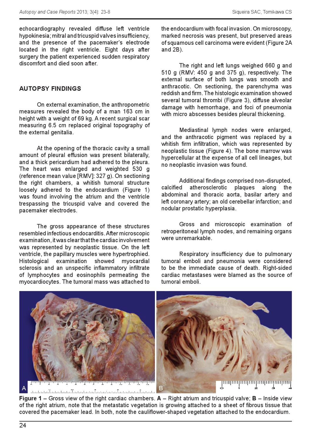 Autopsy & Case Reports by Editora Cubo - Issuu