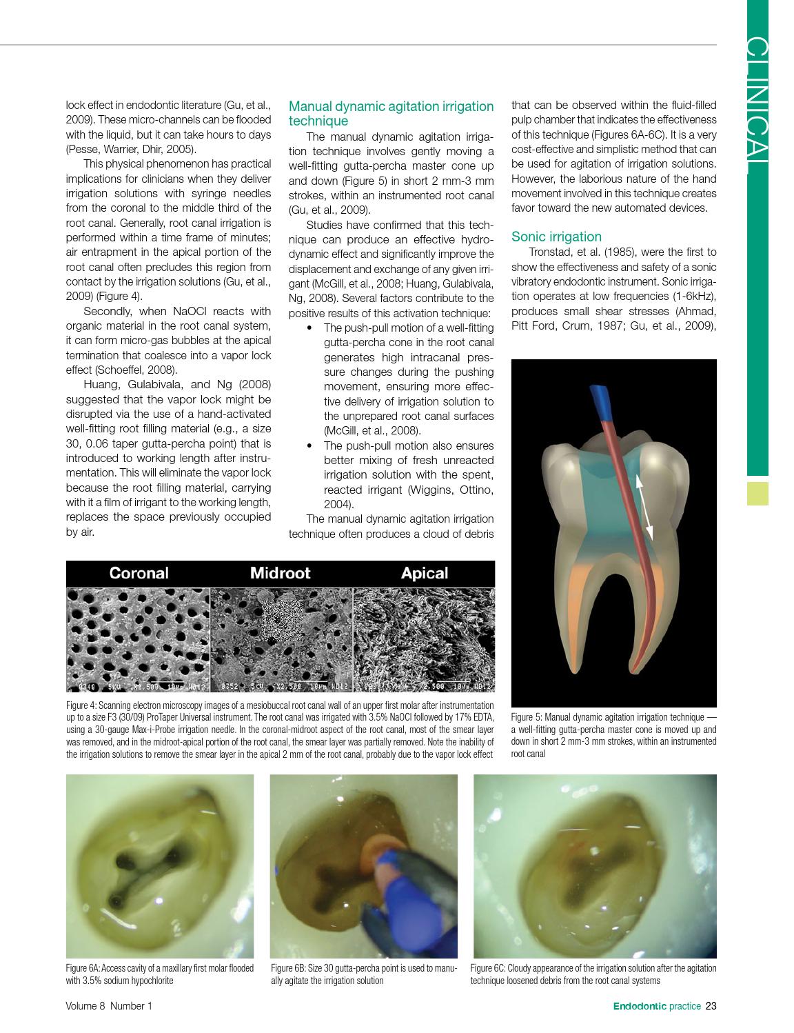 Endodontic Practice US - January/February 2015 Issue - Vol8.1 by MedMark, LLC - Issuu