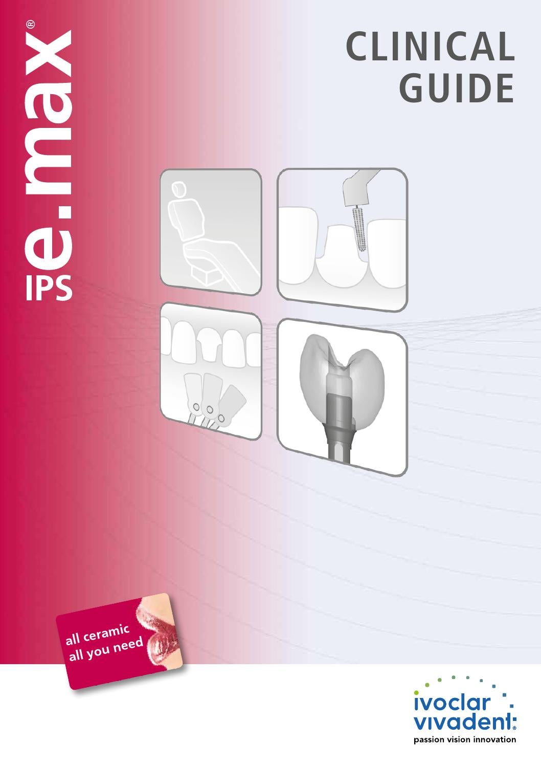 IPS e.max Clinical Guide by Ivoclar Vivadent - Issuu