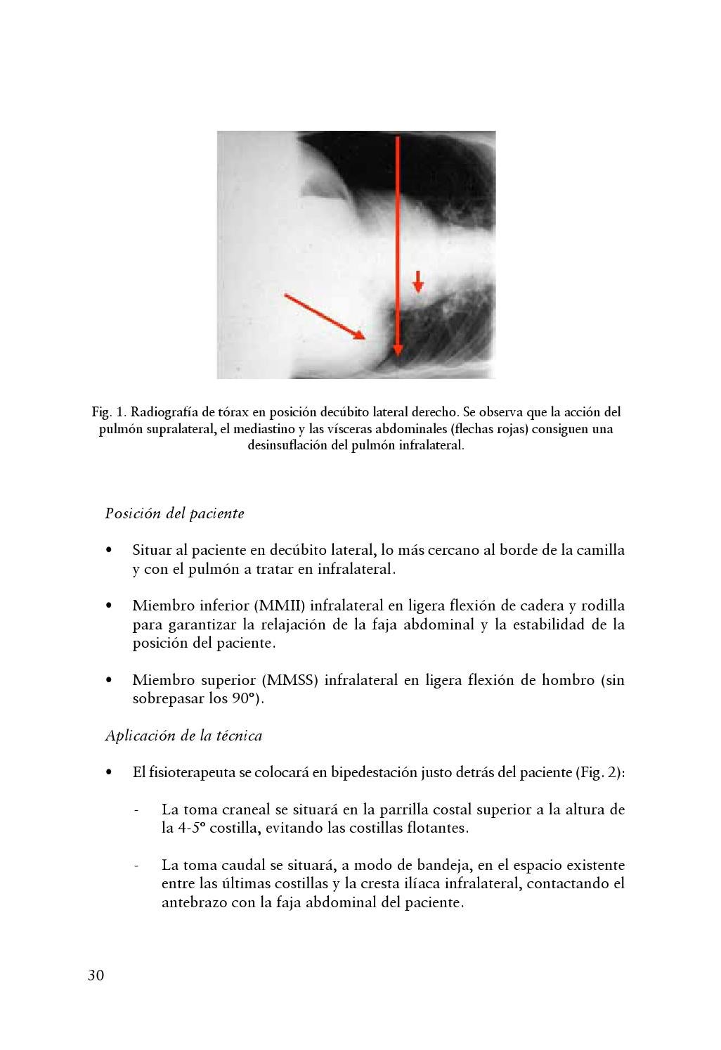 Manual SEPAR 27.Técnicas manuales e instrumentales para el drenaje de secreciones bronquiales en ...