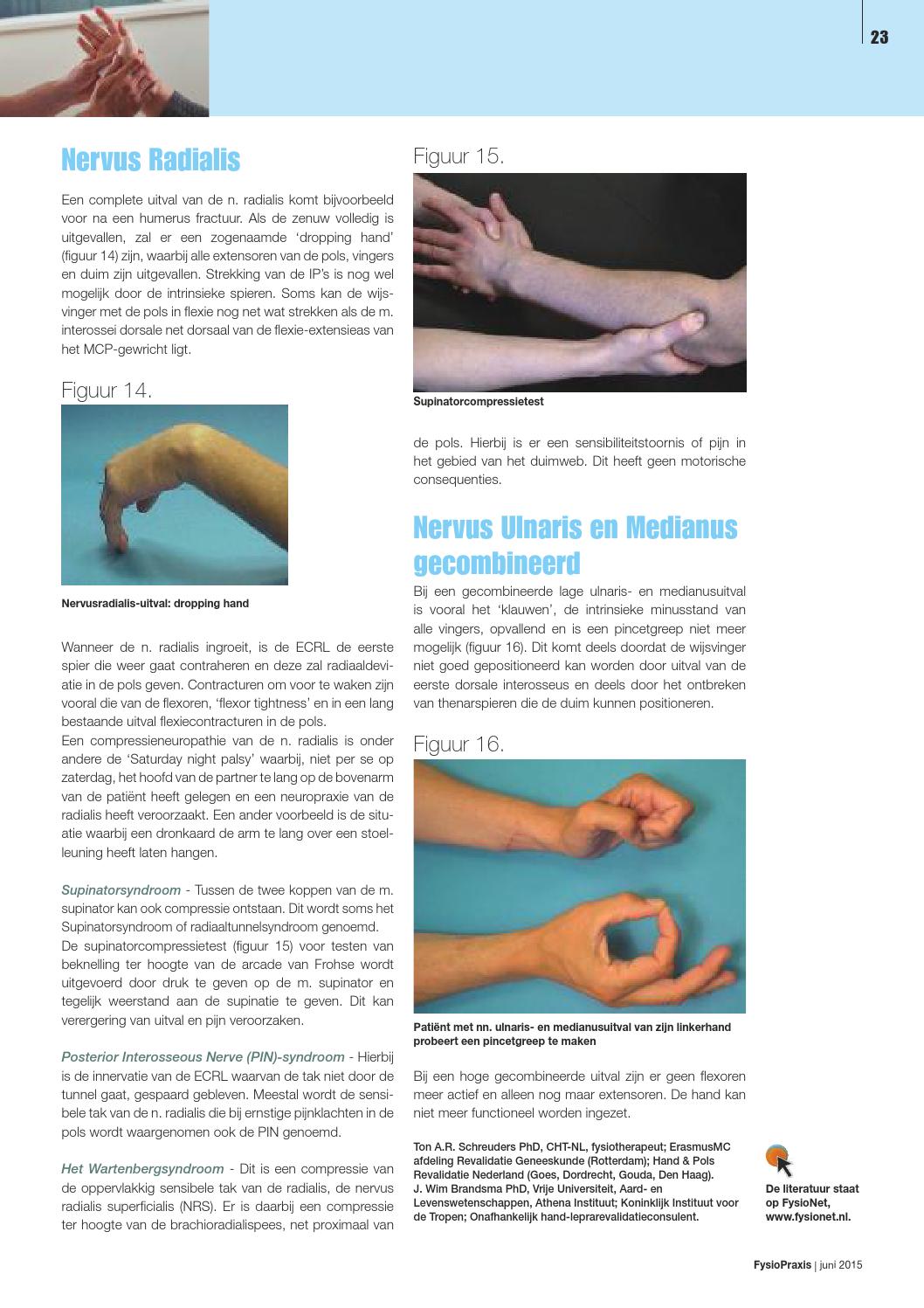 Fysiopraxis juni 2015 by KNGF de Fysiotherapeut - Issuu