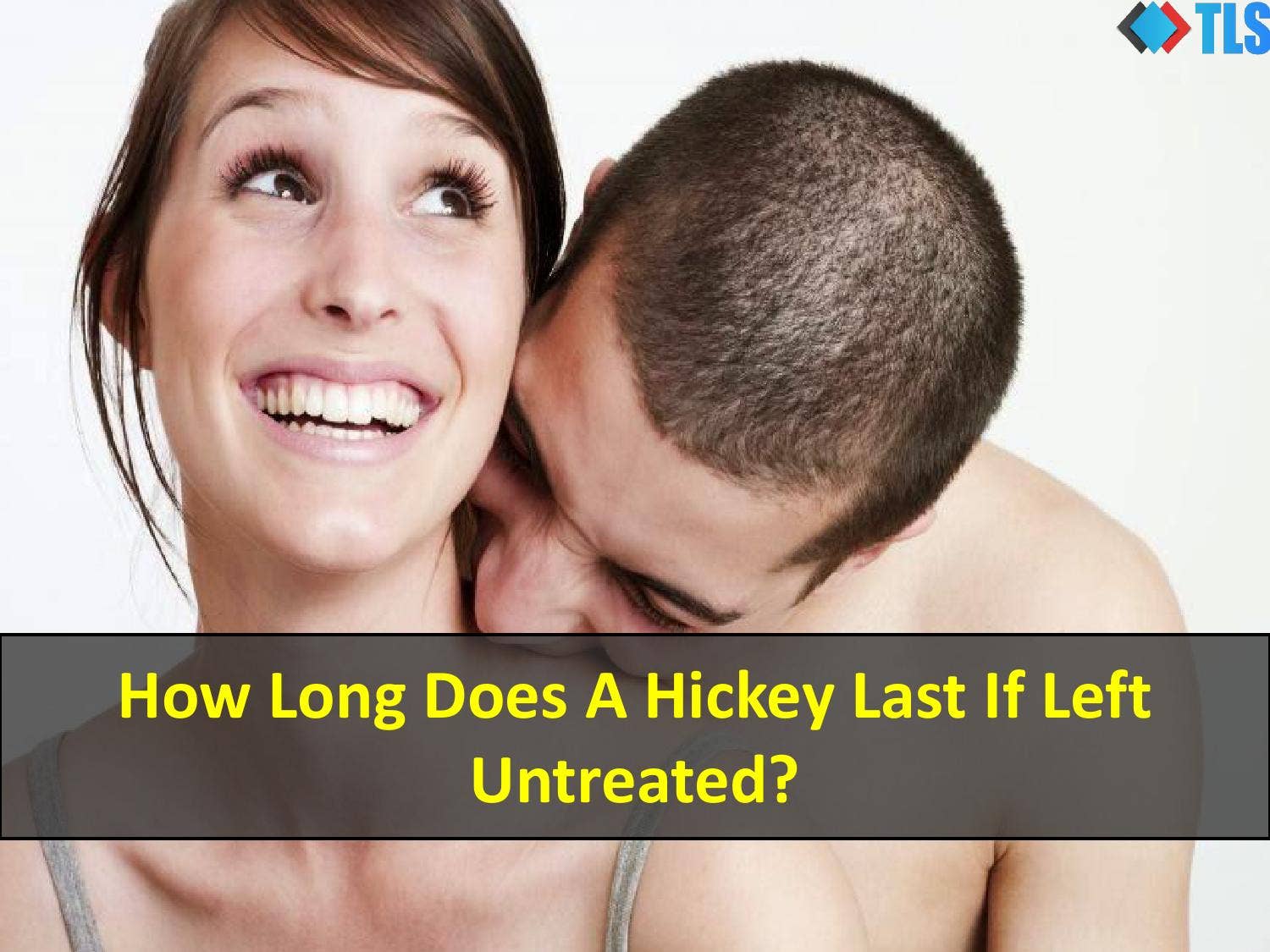 How Long Does A Hickey Last If Left Untreated by TheLifeSquare - Issuu
