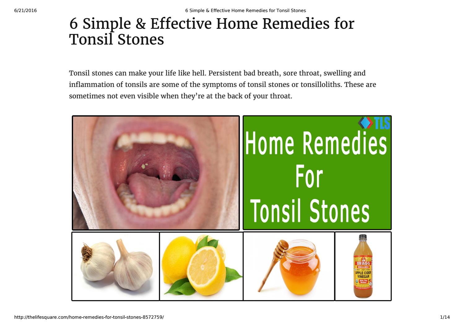 6 Best Home Remedies for Tonsil Stones by TheLifeSquare - Issuu