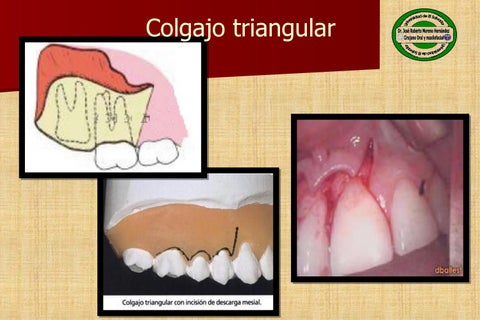 Preparación del colgajo by jmor_her99 - Issuu