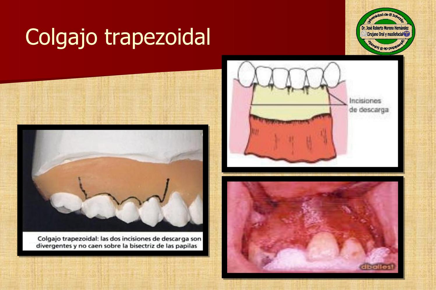 Preparación del colgajo by jmor_her99 - Issuu