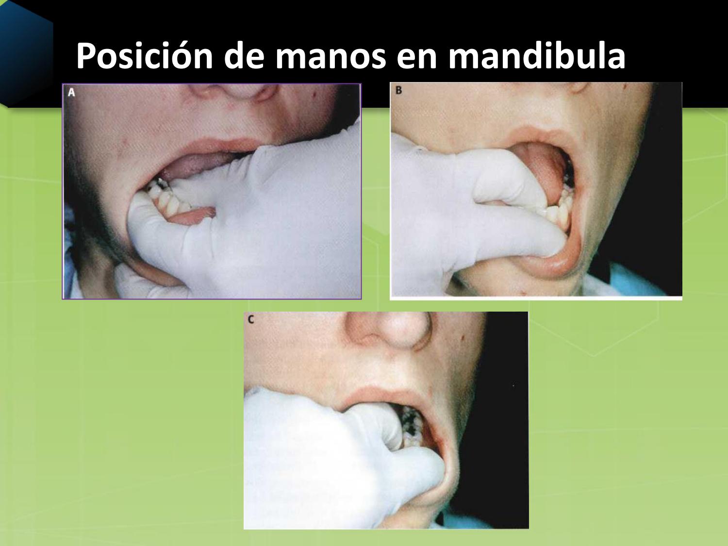 Tecnica de exodoncia by jmor_her99 - Issuu