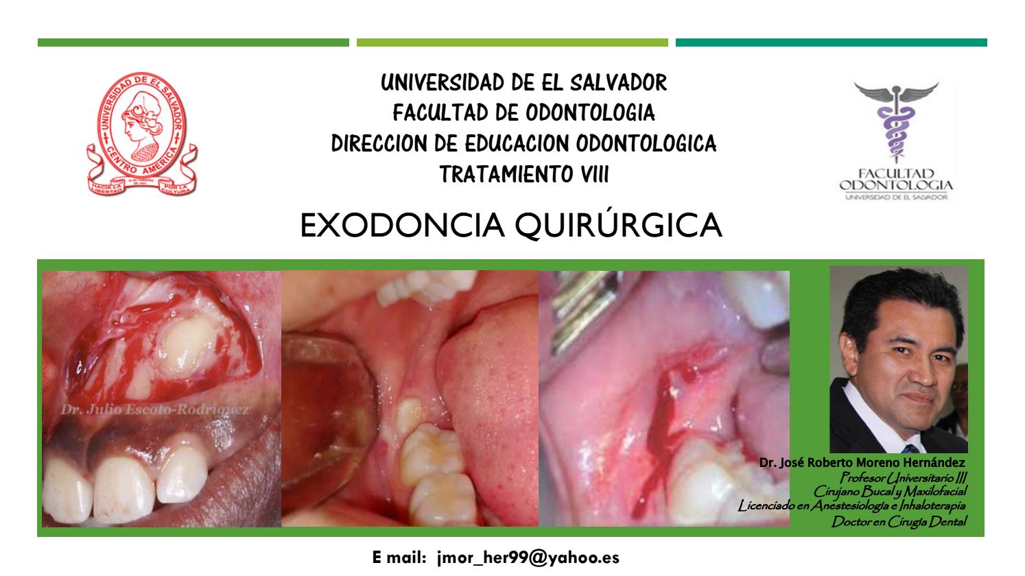 Exodoncia quirúrgica by jmor_her99 - Issuu