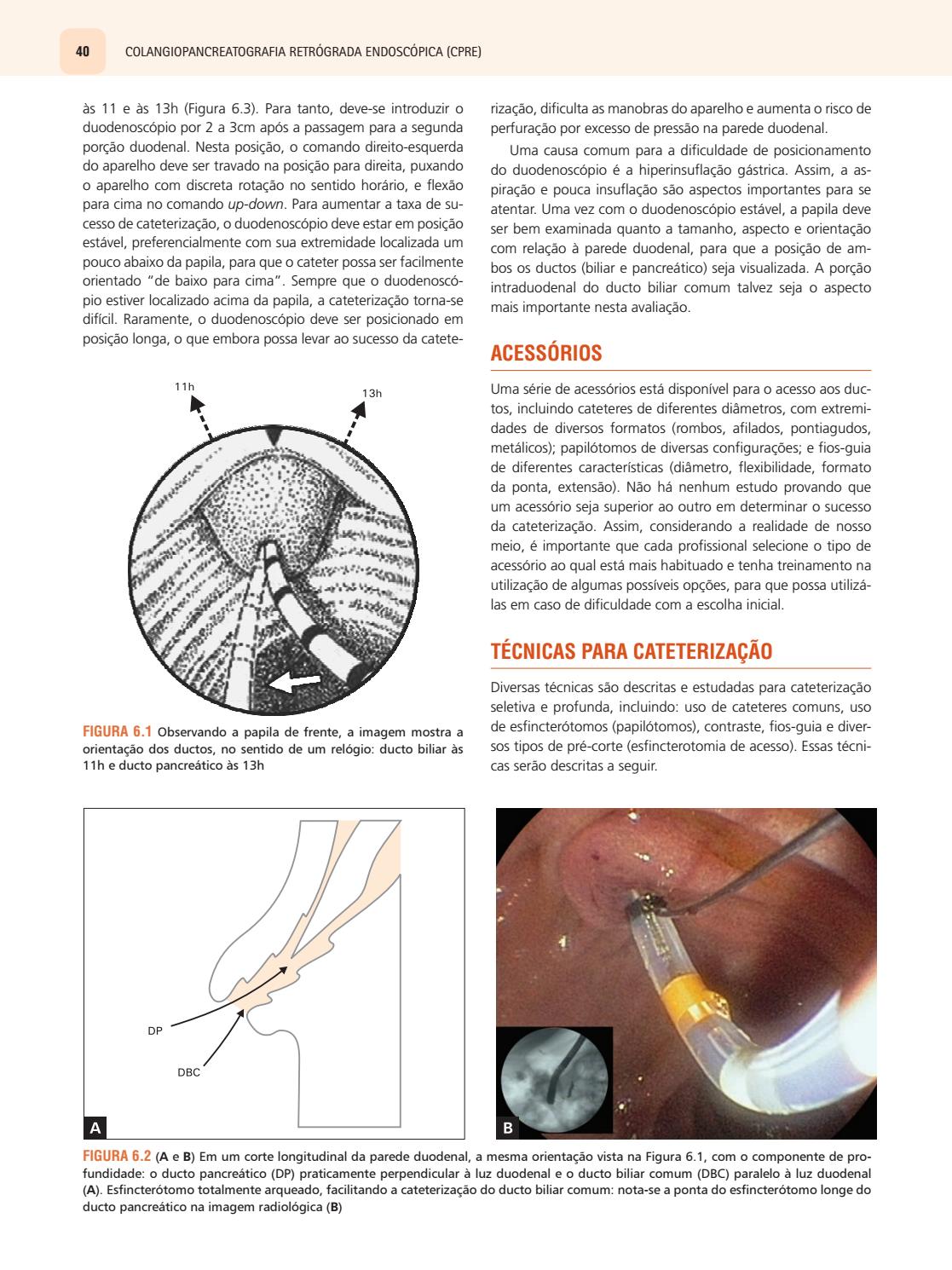 CPRE – Colangiopancreatografia Retrógrada Endoscópica | Angelo P ...