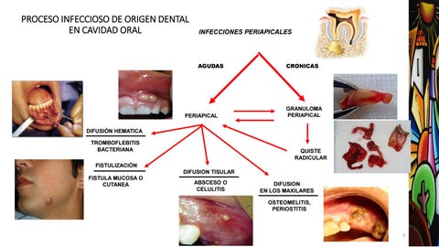 Manejo del proceso infeccioso de origen dental en niños by jmor_her99 ...
