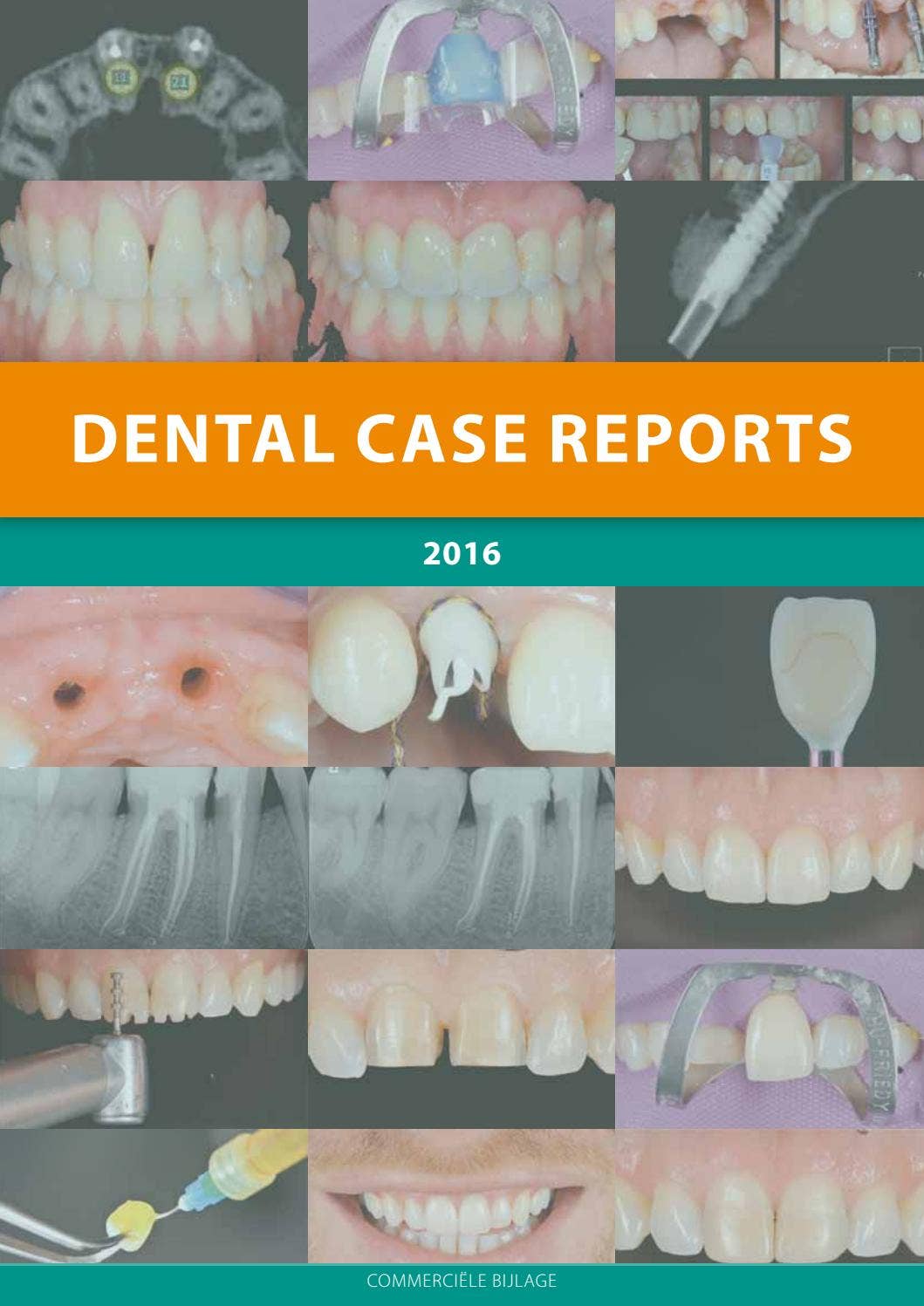 Dental case reports 2016 by Prelum - Issuu