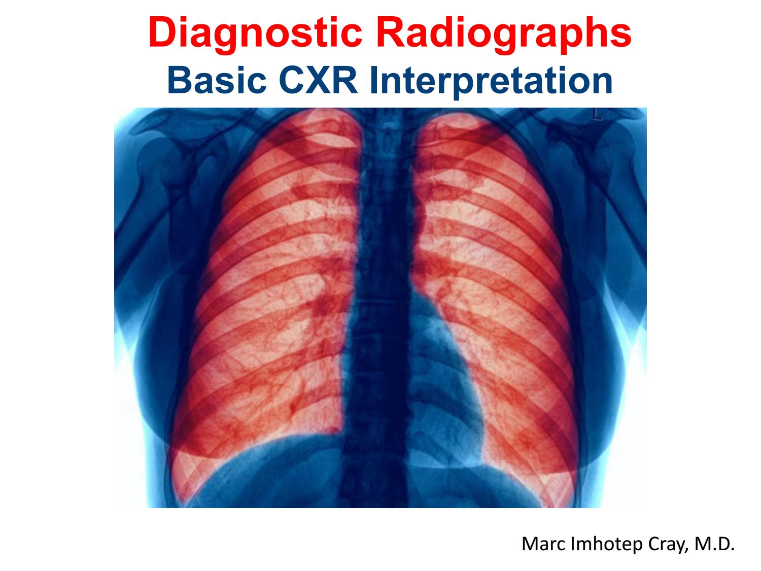 Basic CXR Interpretation_Diagnostic Radiographs by Marc Imhotep Cray, M ...