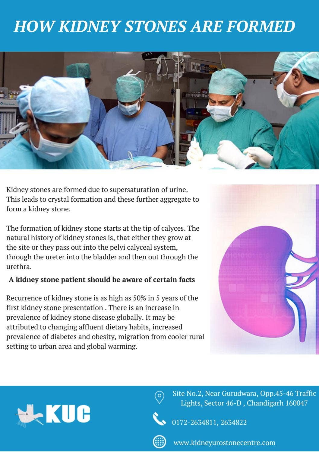 How kidney stones are formed by Kapoor's Kidney & Urostone Centre Pvt ...