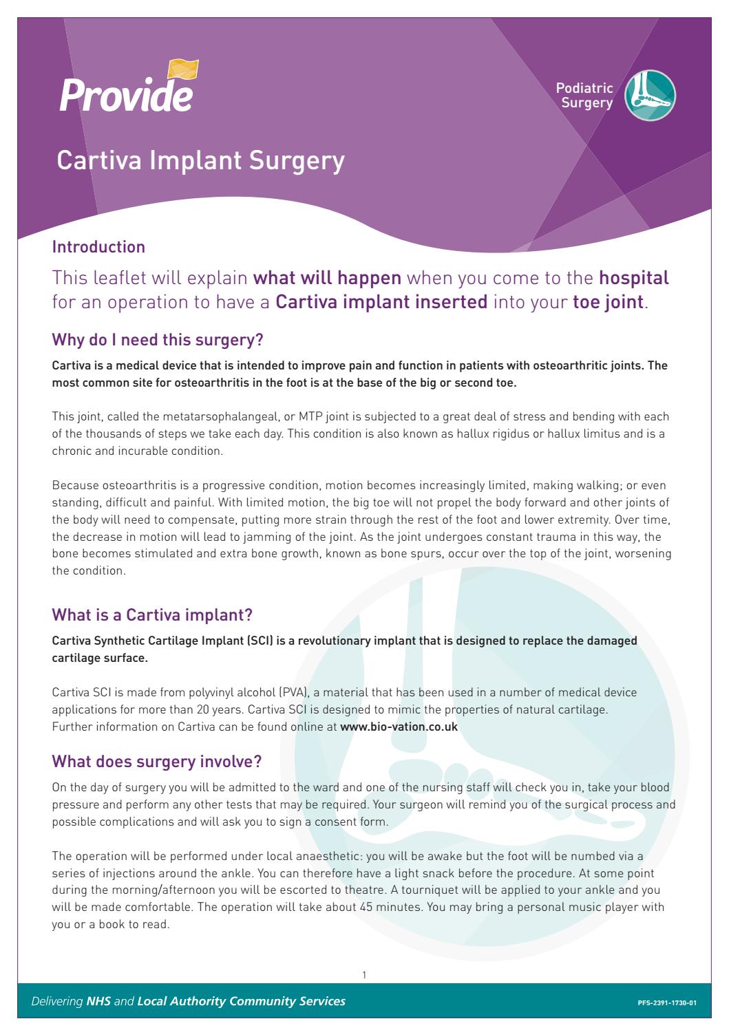Cartiva implant surgery aug 2017 by Provide CIC - Issuu