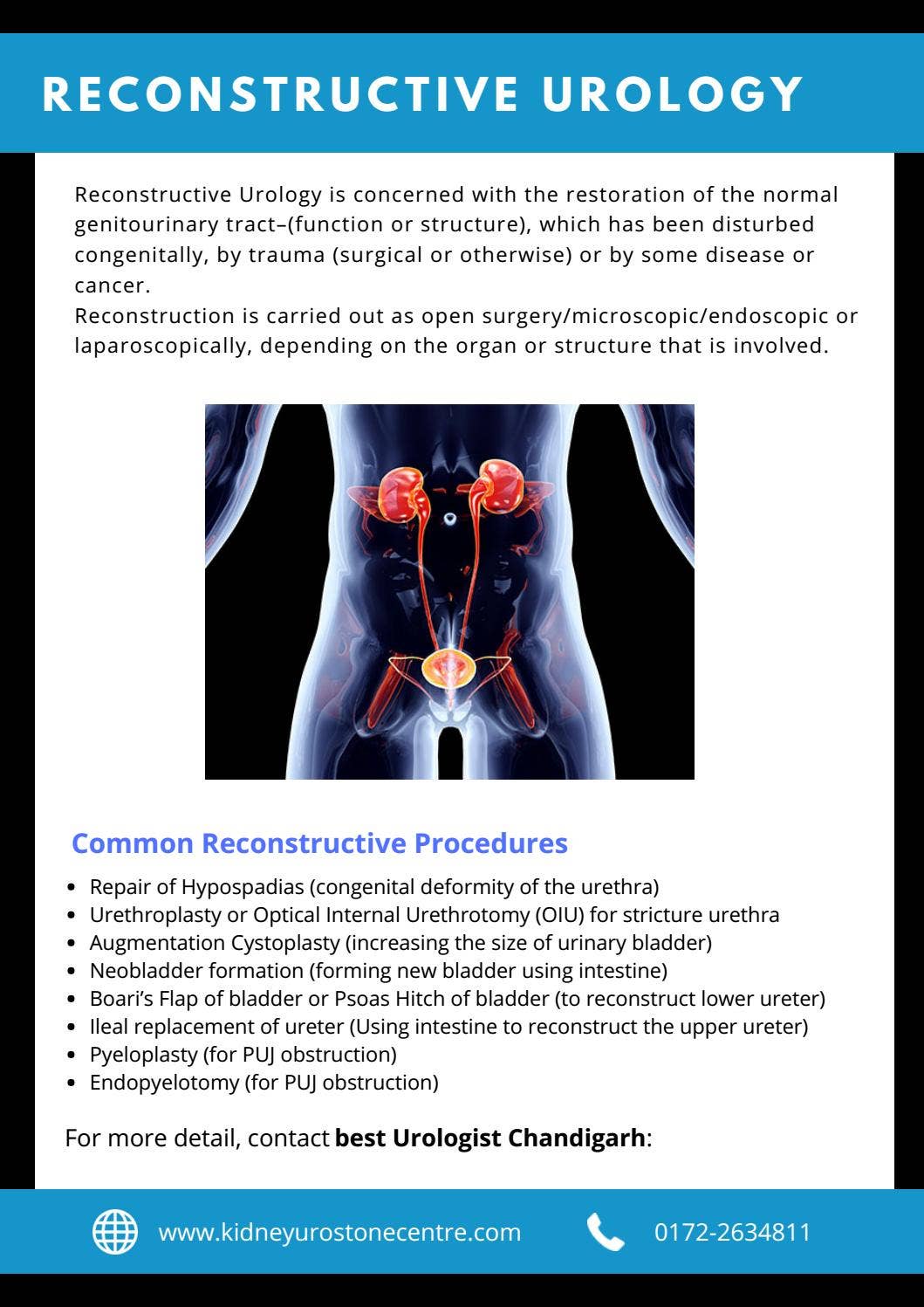 Reconstructive Urology Procedures by Kapoor's Kidney & Urostone Centre ...