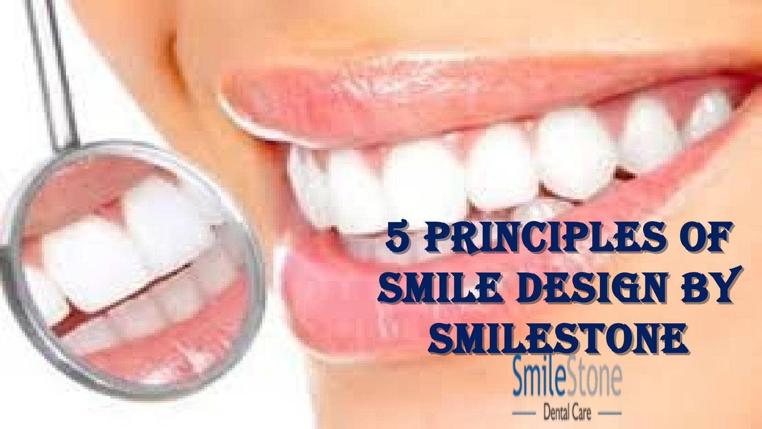 5 Principles of Smile Design By Smilestone by Smilestone Dental Care ...