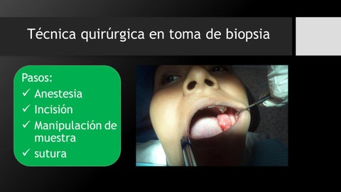 Biopsia en odontologia by jmor_her99 - Issuu