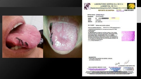 Biopsia en odontologia by jmor_her99 - Issuu