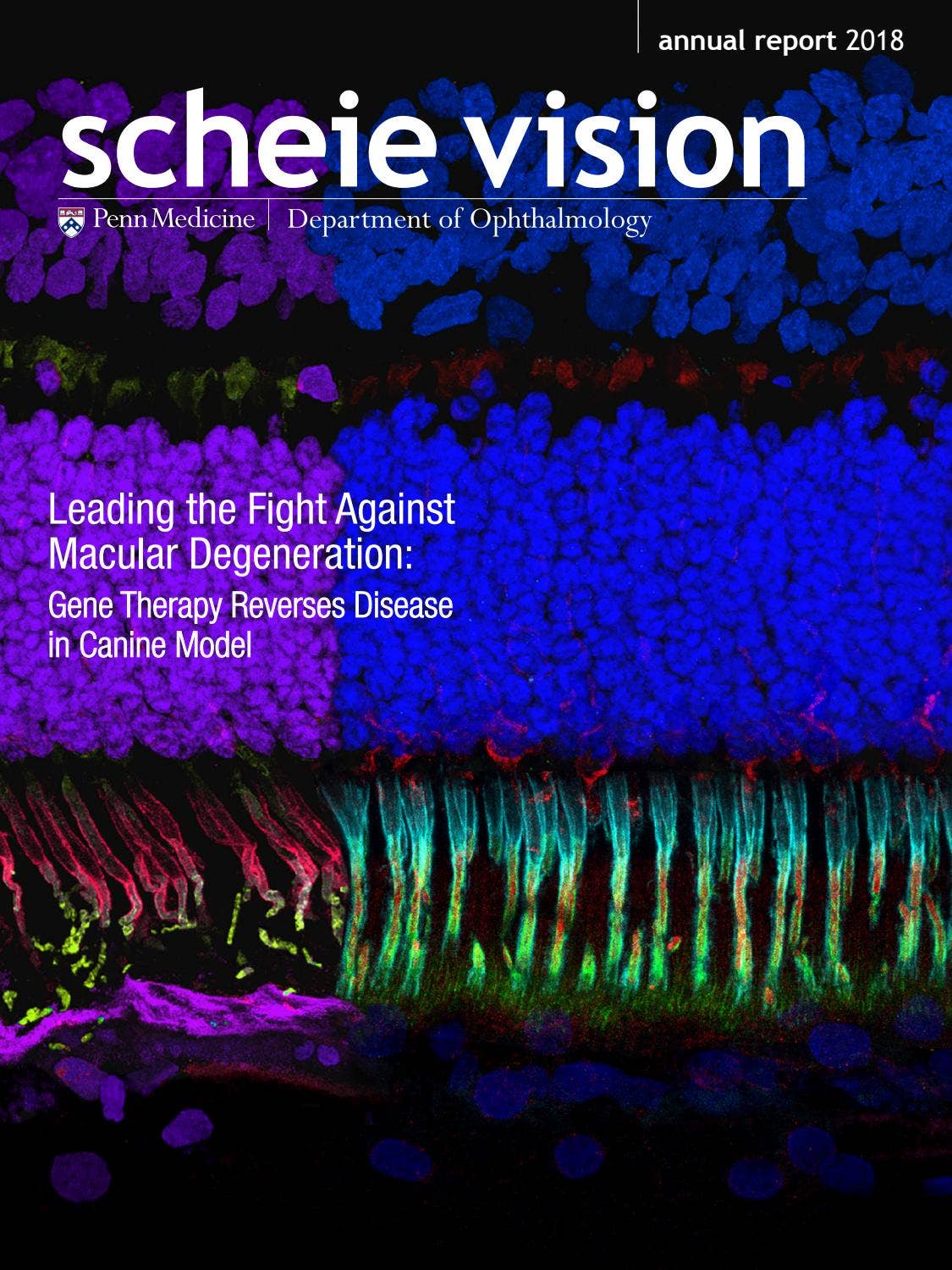 Annual Report 2018 - Scheie Eye Institute by The Department of ...