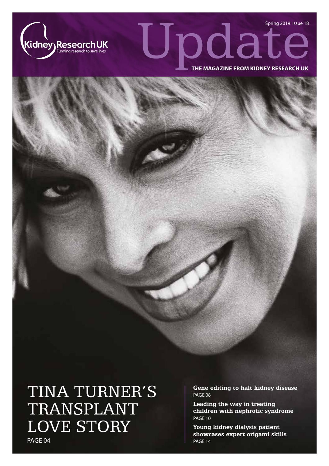 Update Magazine Spring 2019 Issue 18 by Kidney Research UK - Issuu