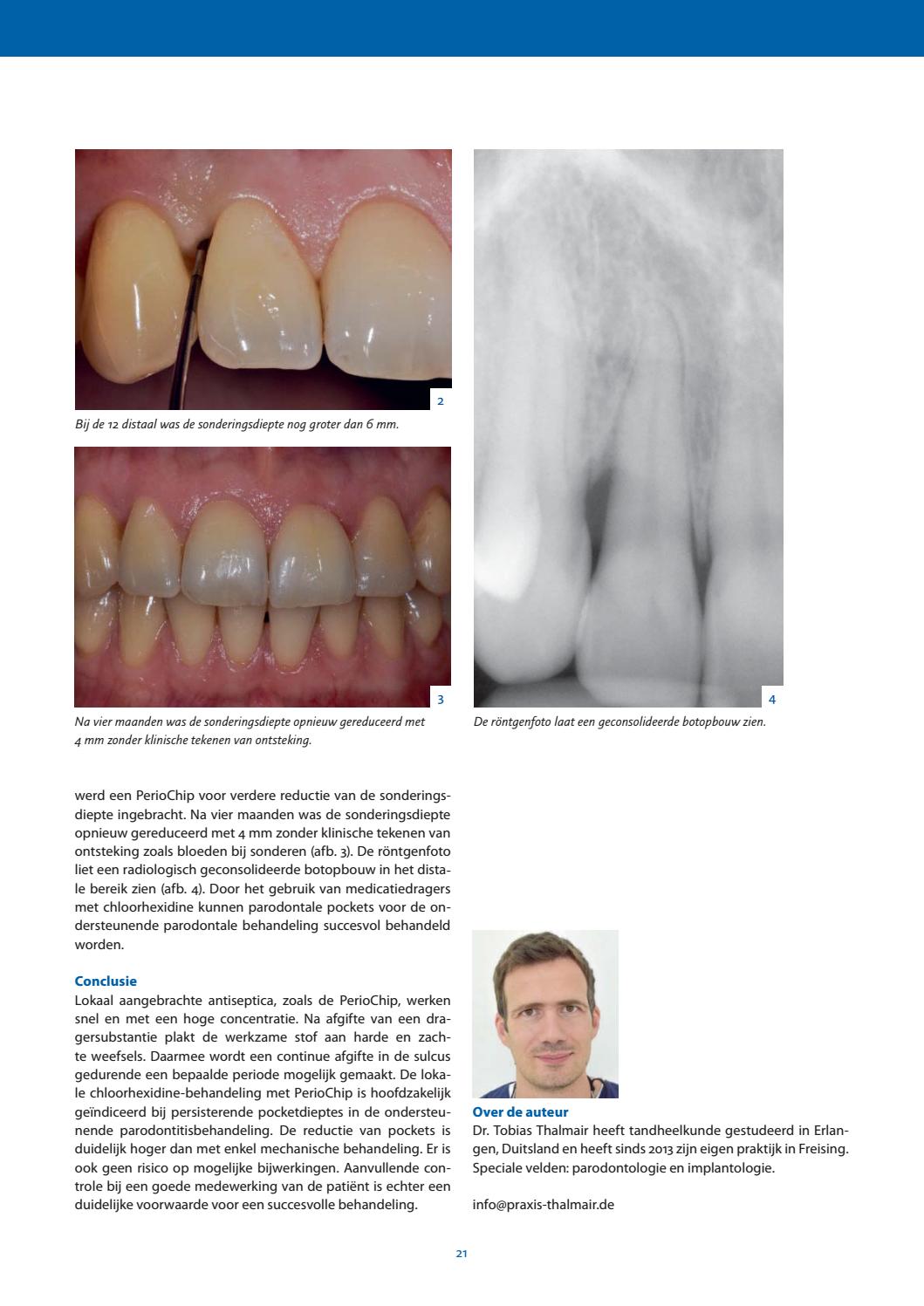 Dental Case Reports 2018 by Prelum - Issuu