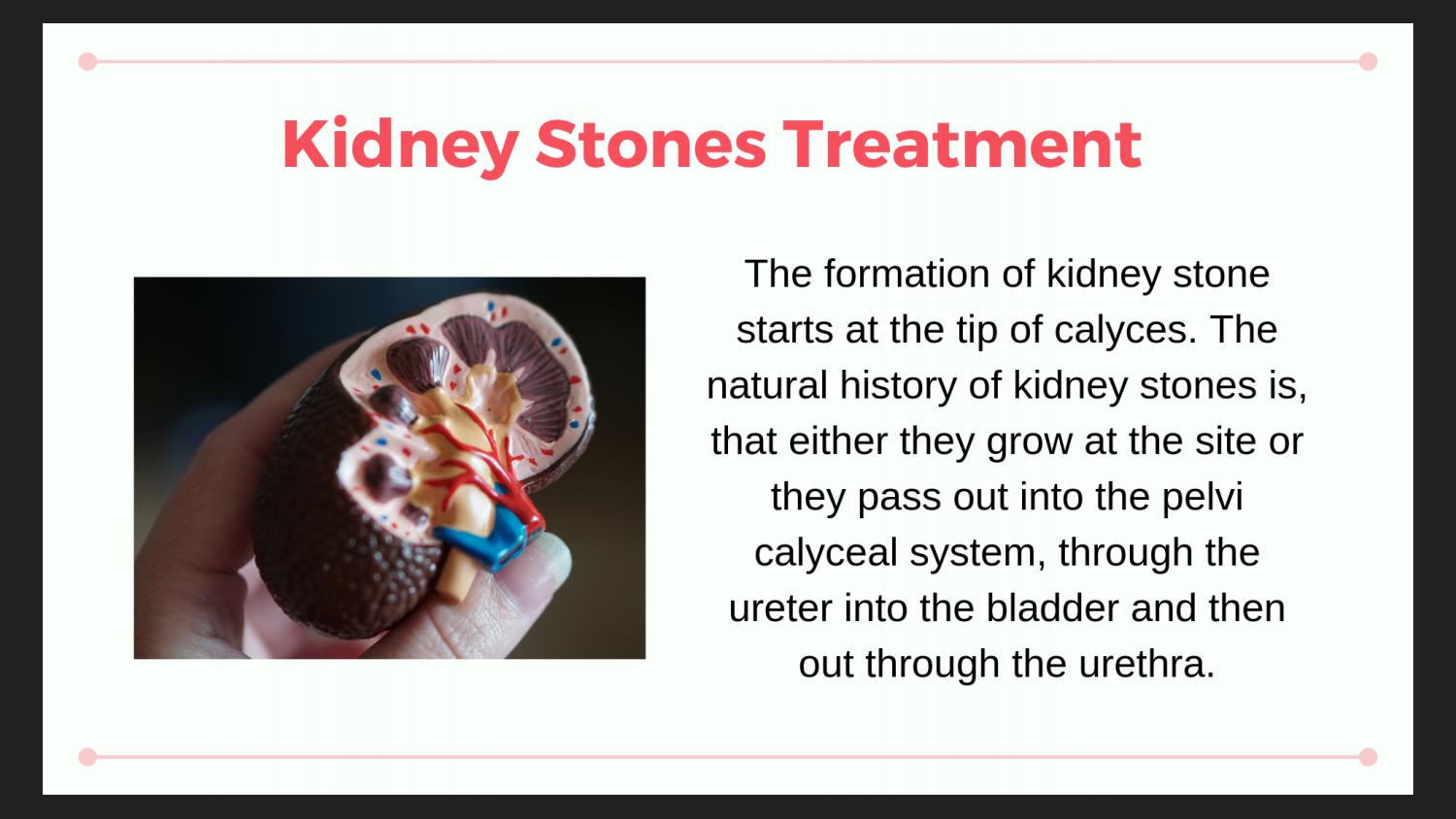 Kidney Stones Treatment by Kapoor's Kidney & Urostone Centre Pvt. Ltd ...
