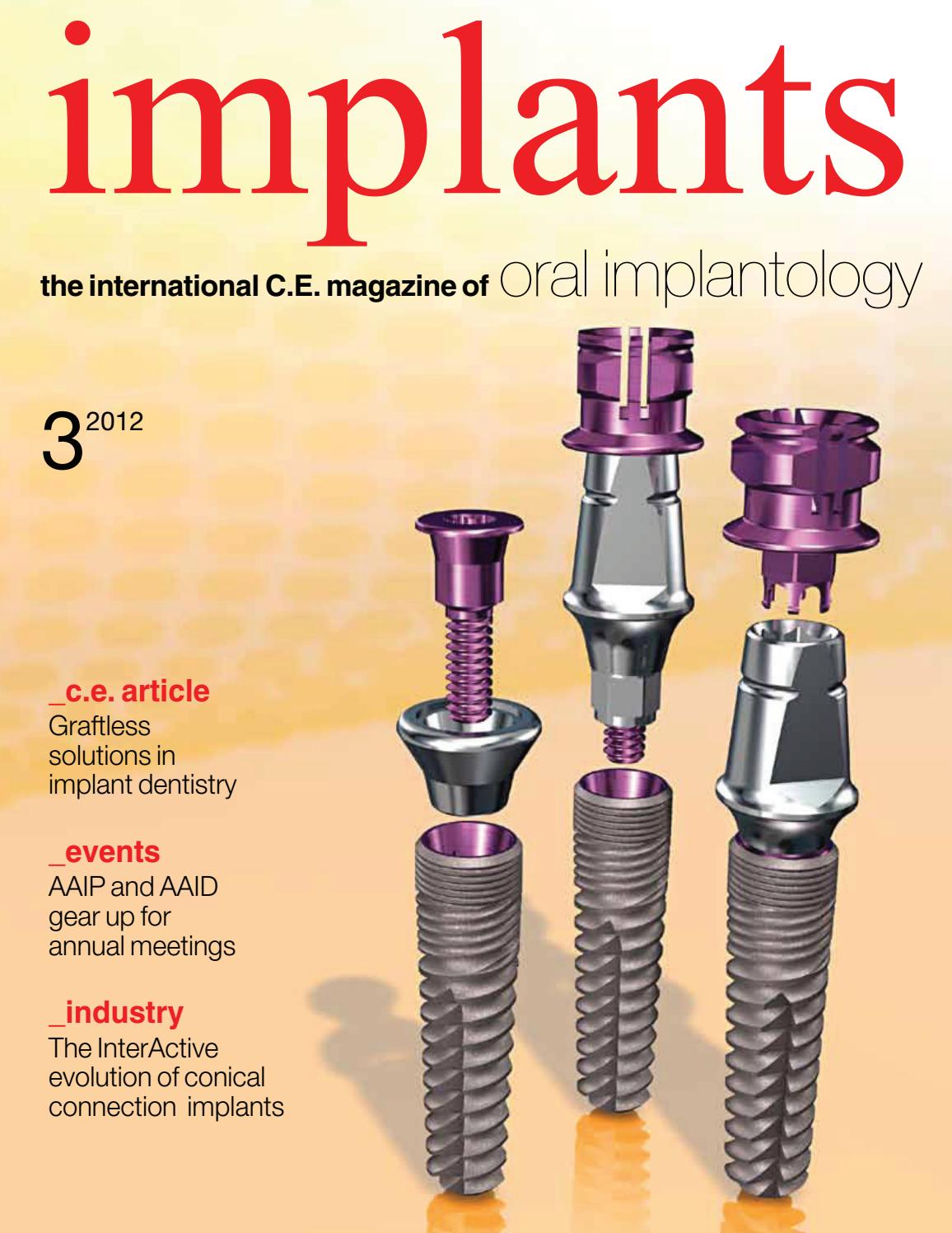 The Interactive Evolution of Conical Connection Implants 2012 by Dr ...