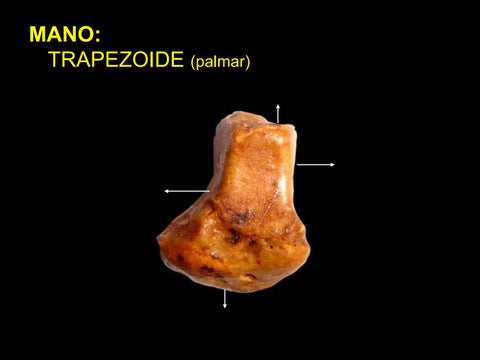 MUSCULOS DEL MIEMBRO SUPERIOR by Señor Enfermerock - Issuu