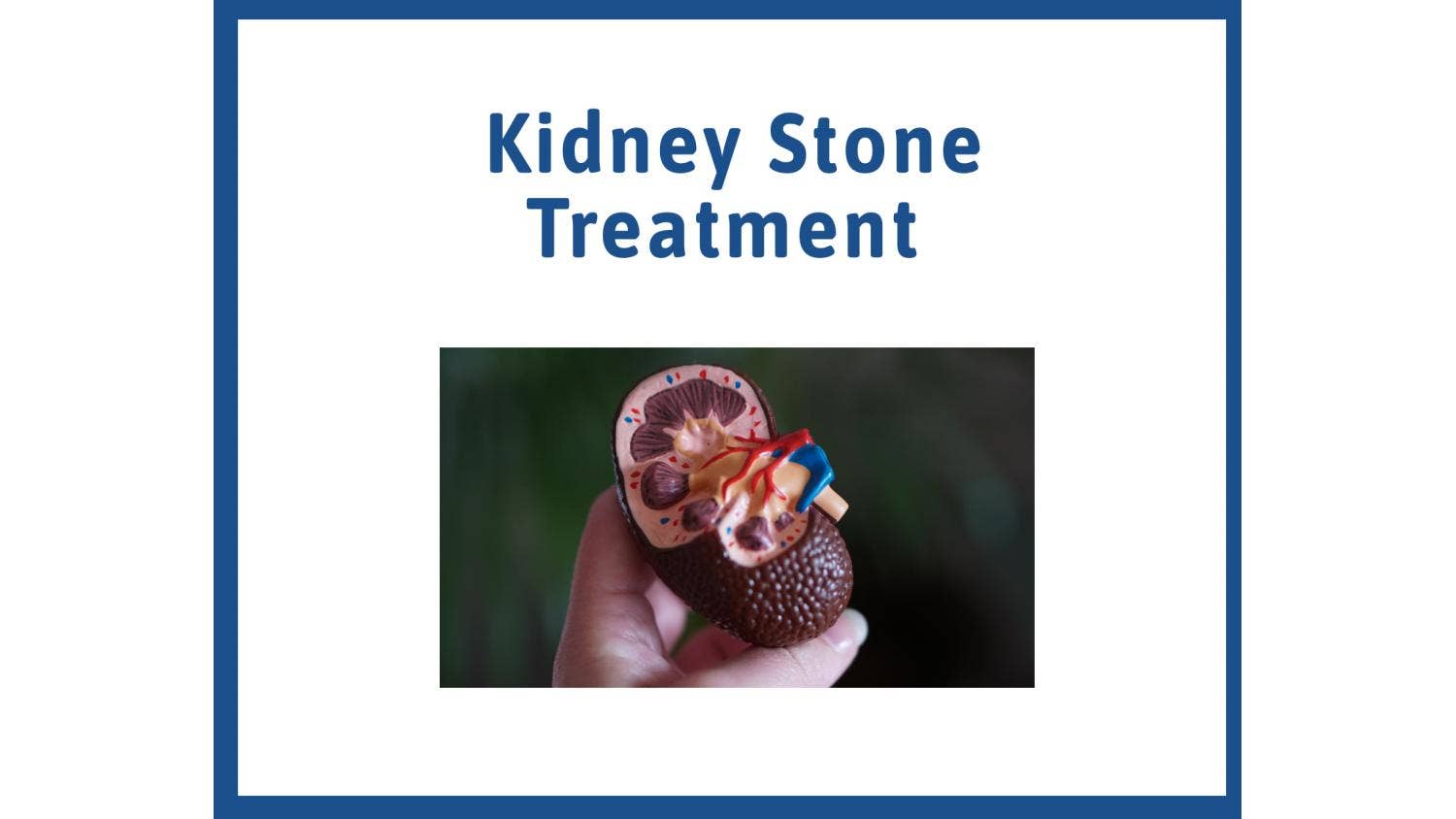 Best Kidney Stone Treatment and Preventions by Kapoor's Kidney ...