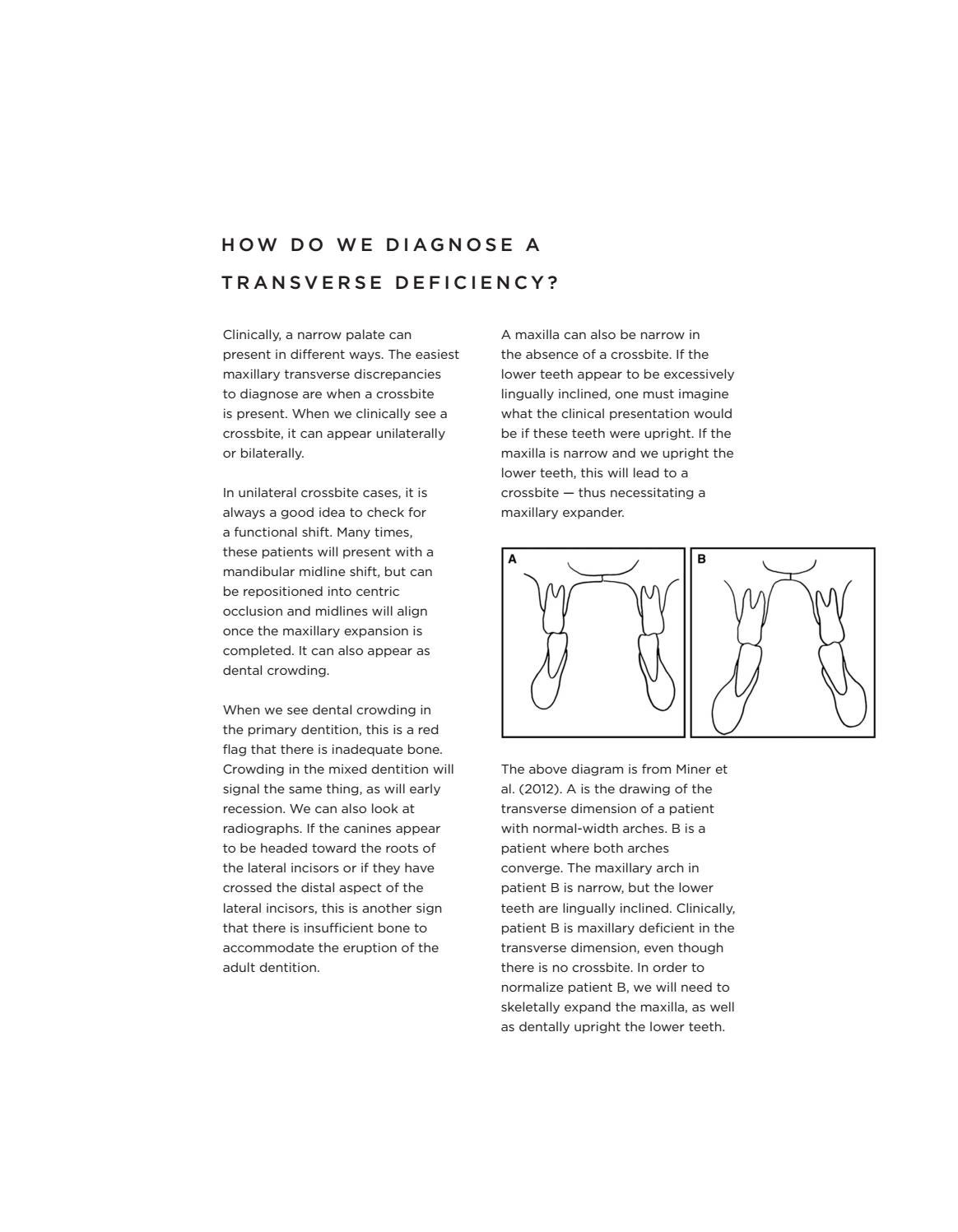 What is the Transverse Dimension and Why Do We Care About it? by Spear ...