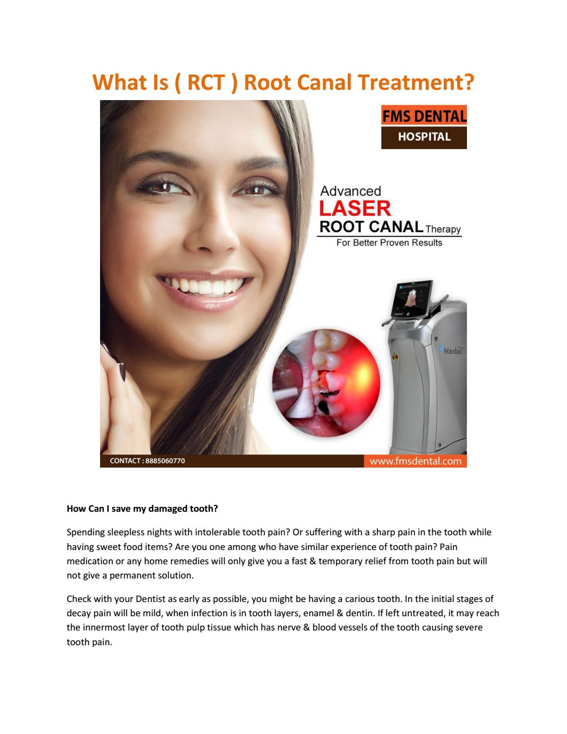 What Is ( RCT ) Root Canal Treatment ? by fmsdentalsamee - Issuu