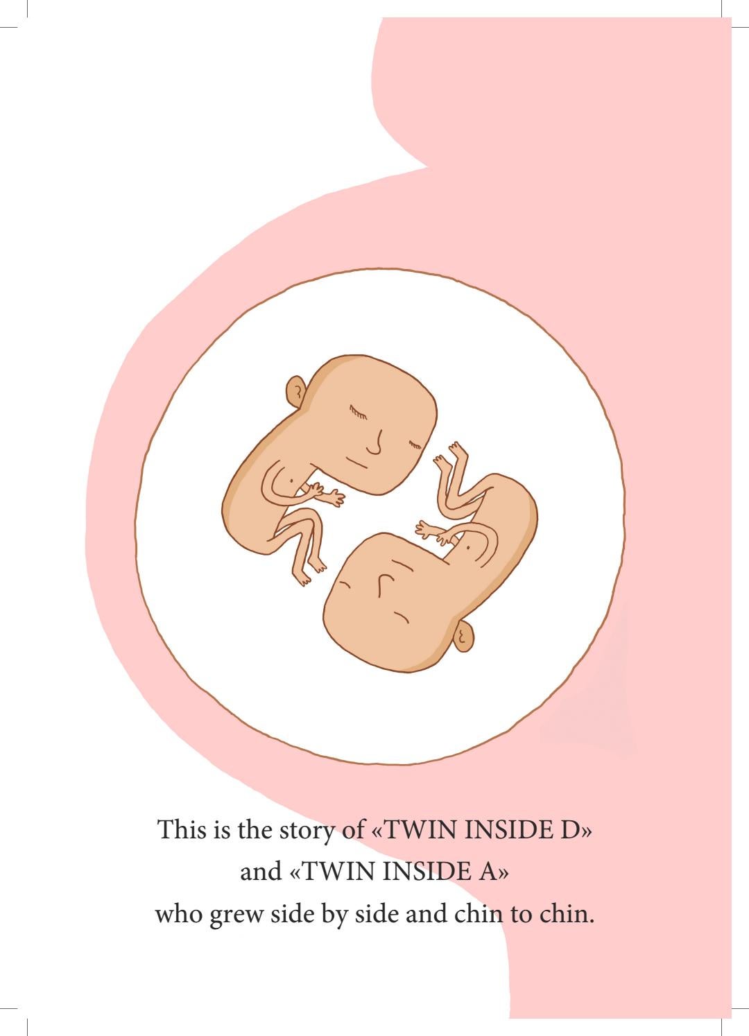 The story of the loss of a twin girl with surviving twin brother by ...