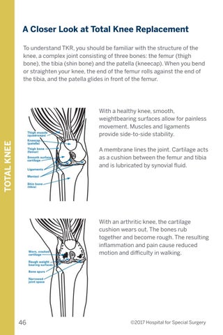 Pathway to Recovery: Patient Guide to Total Joint Replacement (Hip and ...