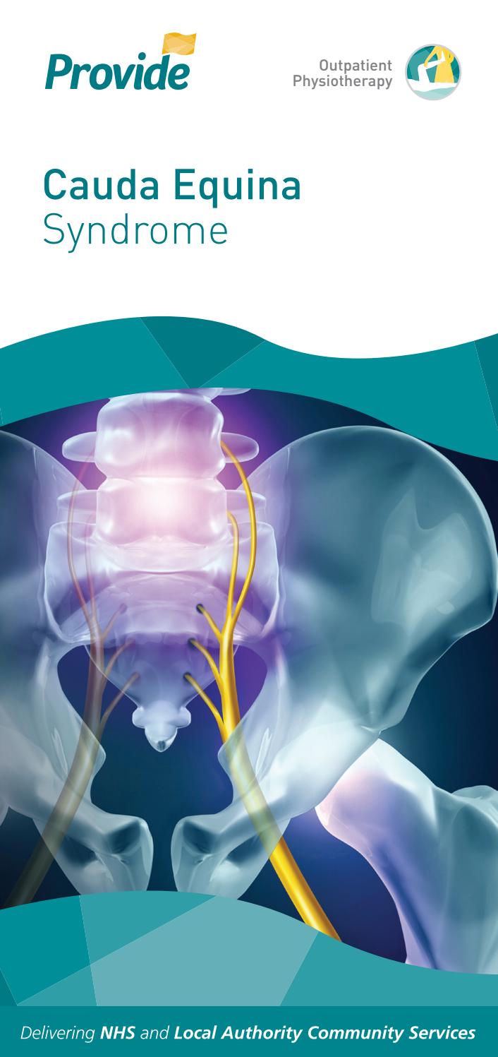 Cauda Equina Sydrome card by Provide CIC - Issuu