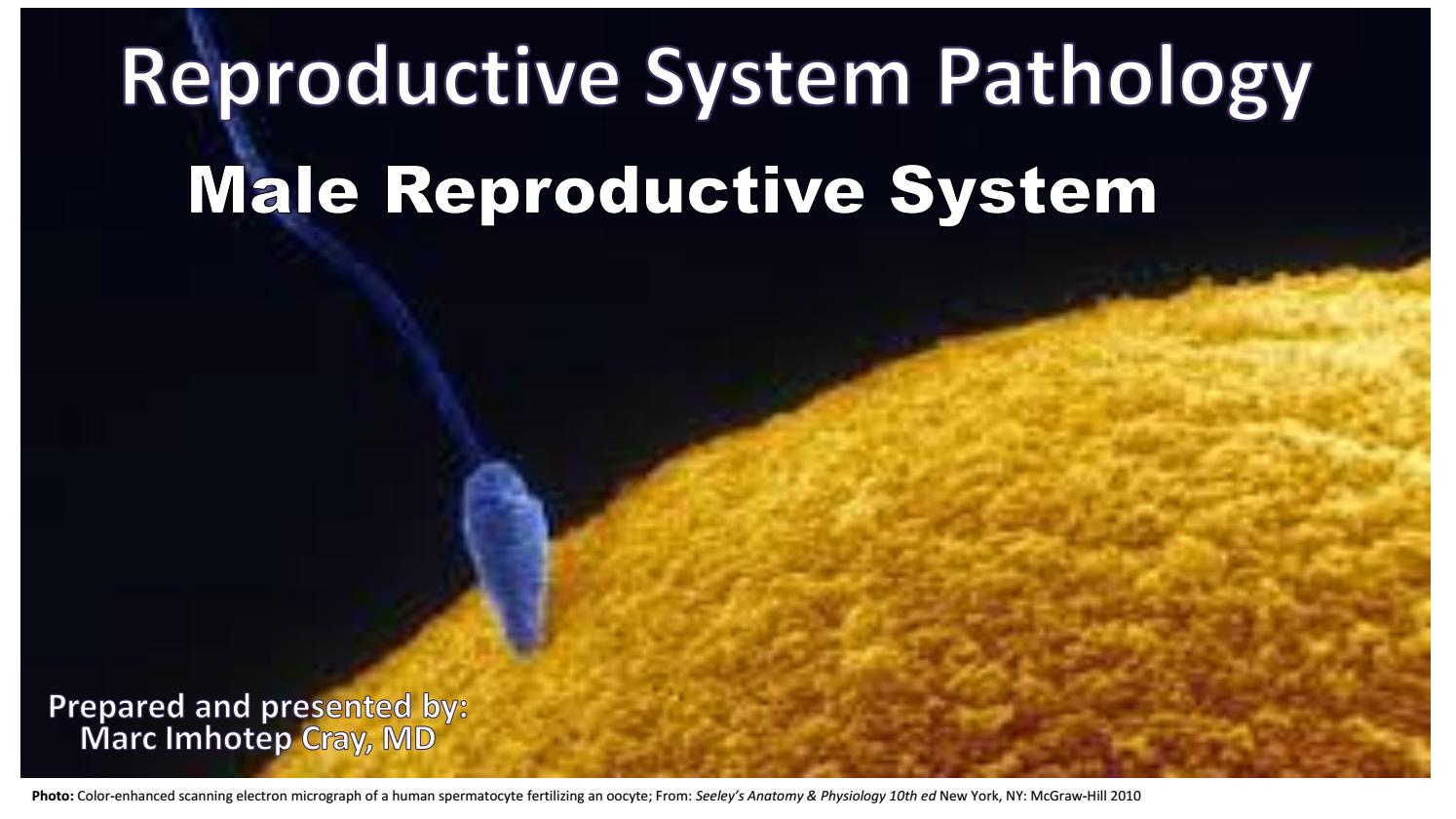 Reproductive System Pathology_Male Reproductive Systems by Marc Imhotep ...