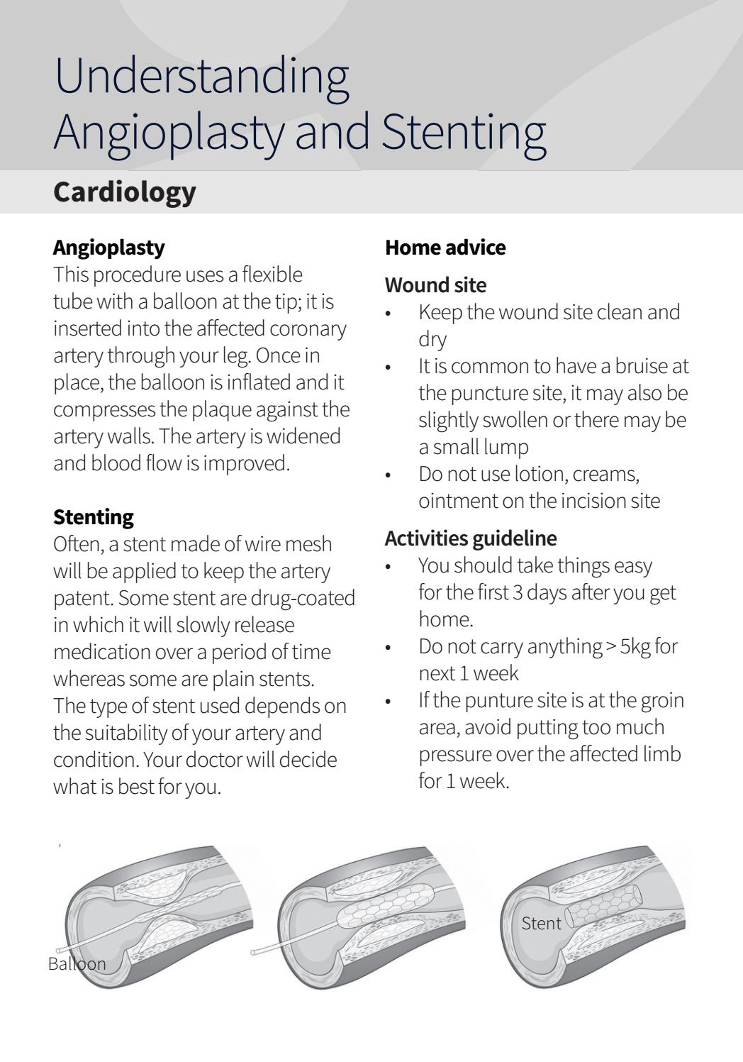 Understanding Angioplasty and Stenting by Yishun Health - Issuu