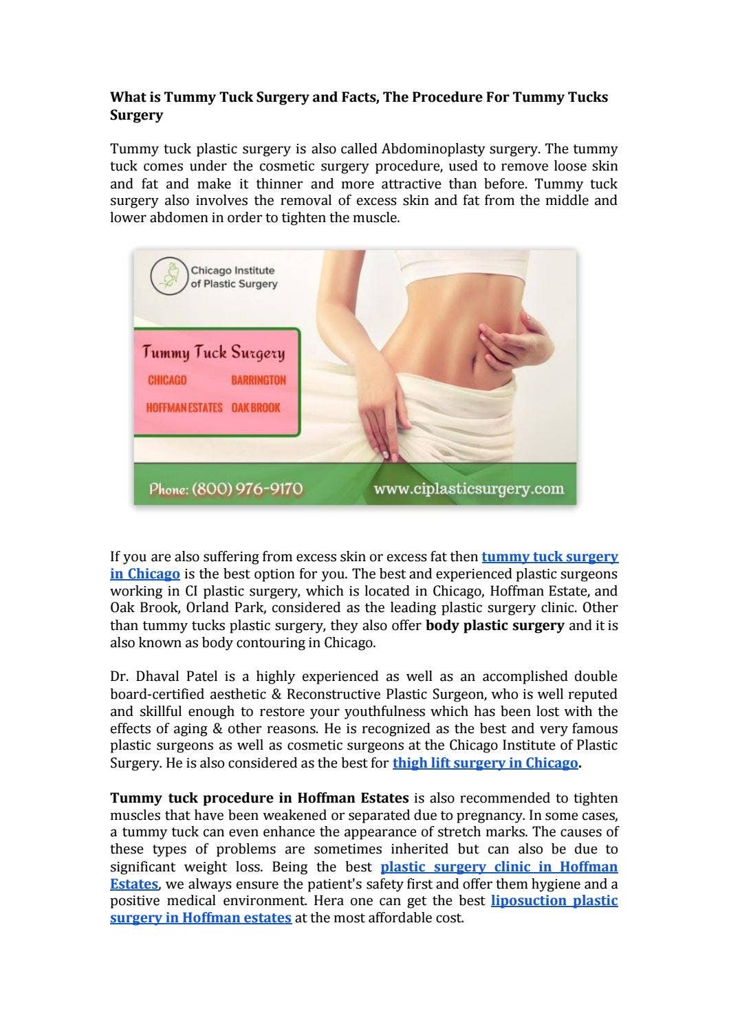 What is Tummy Tuck Surgery and Facts, The Procedure For Tummy Tucks ...