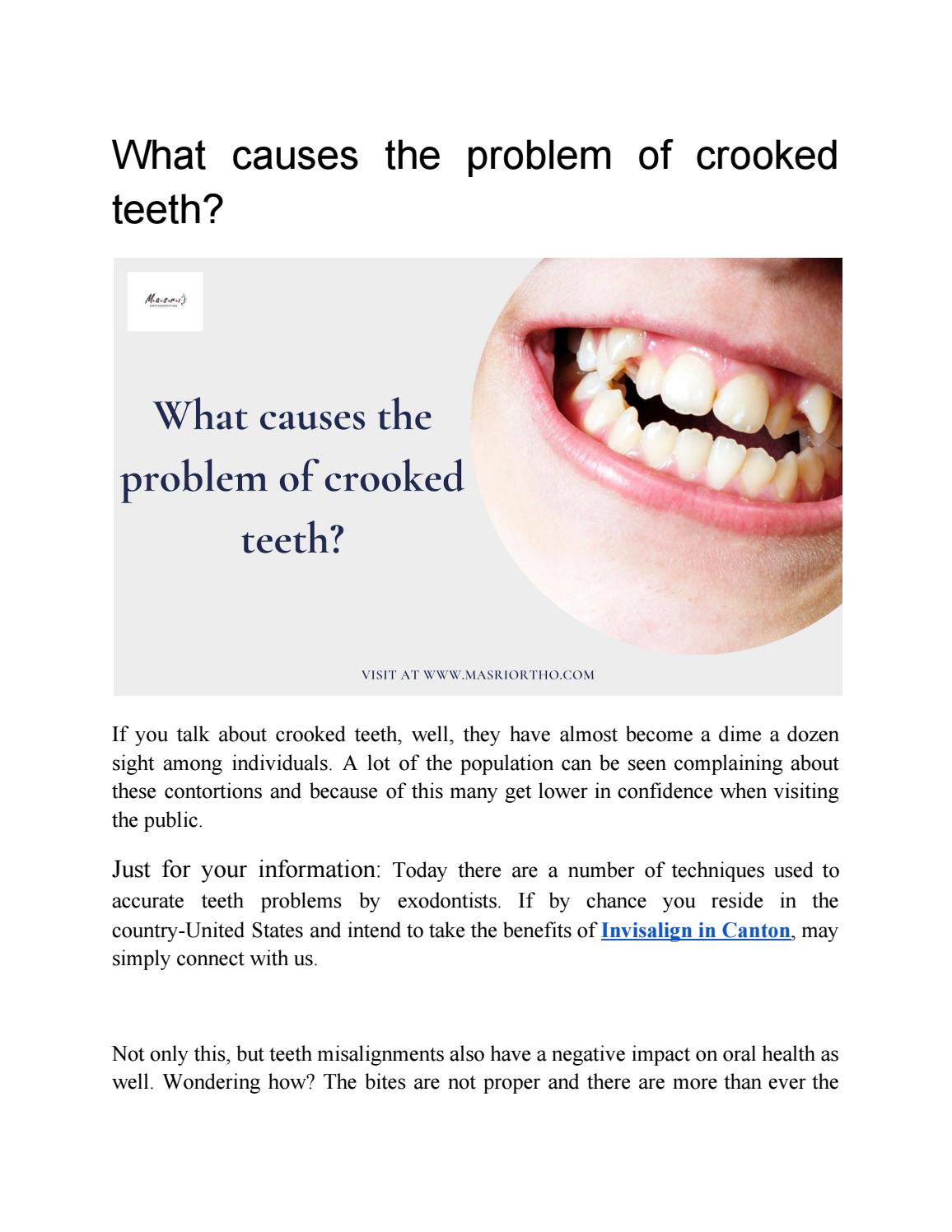What causes the problem of crooked teeth? by Masri Orthodontics - Issuu