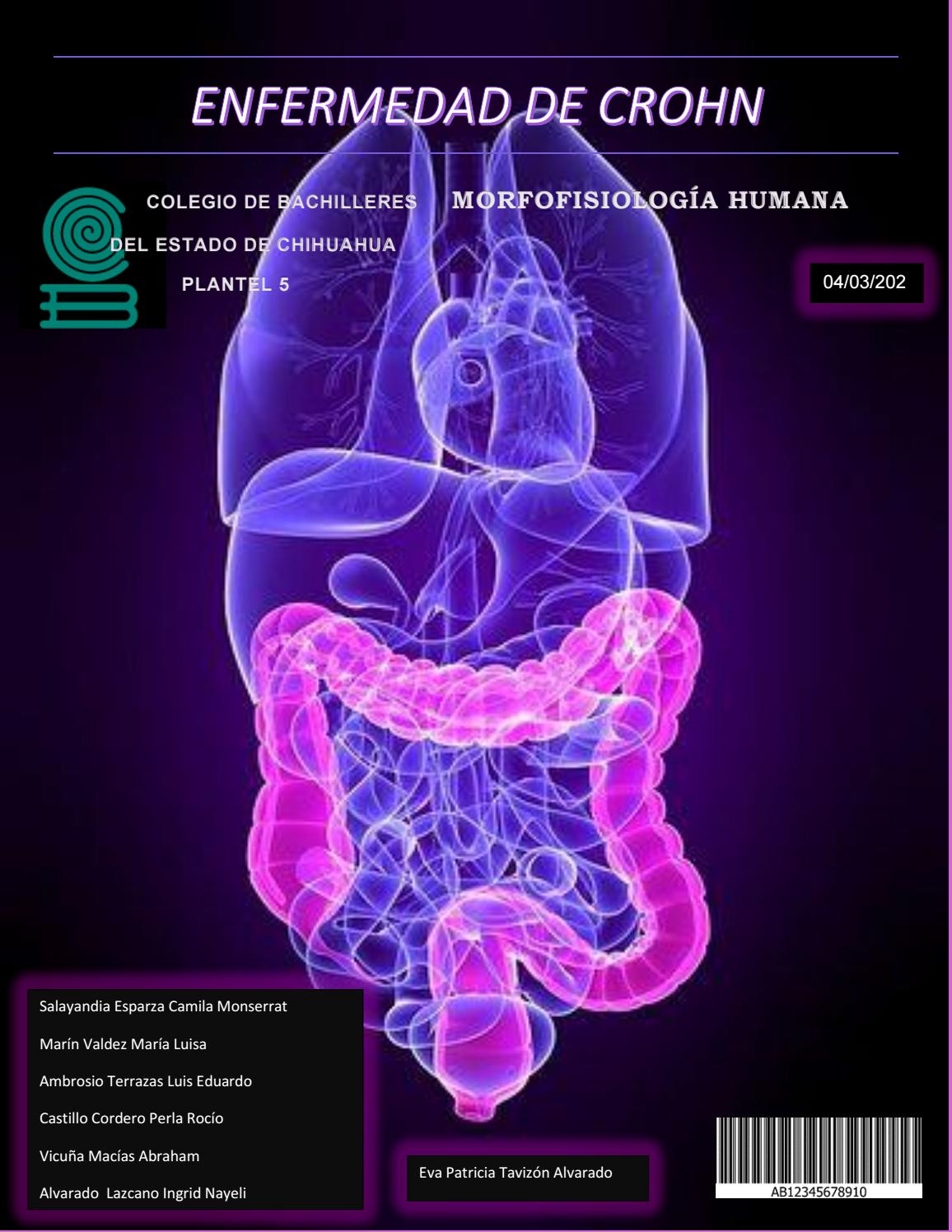 Enfermedad de Crohn by EVA PATRICIA TAVIZON ALVARADO - Issuu