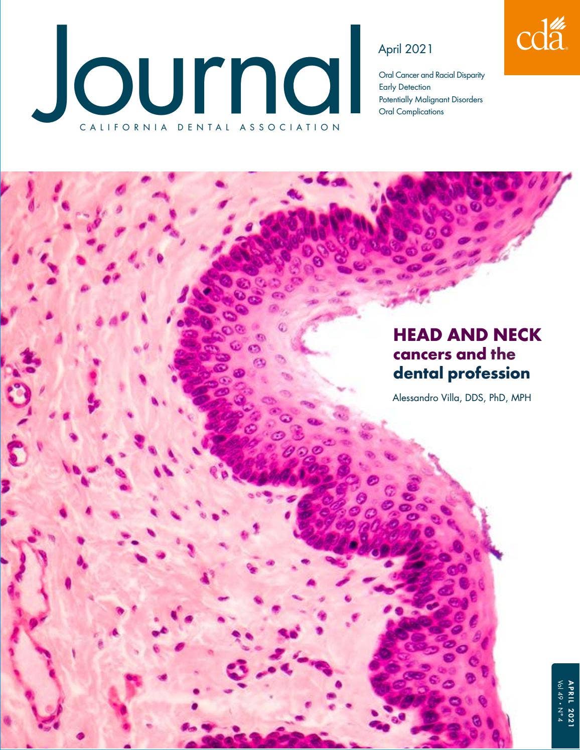 CDA Journal - April 2021: Head and Neck Cancers and the Dental ...