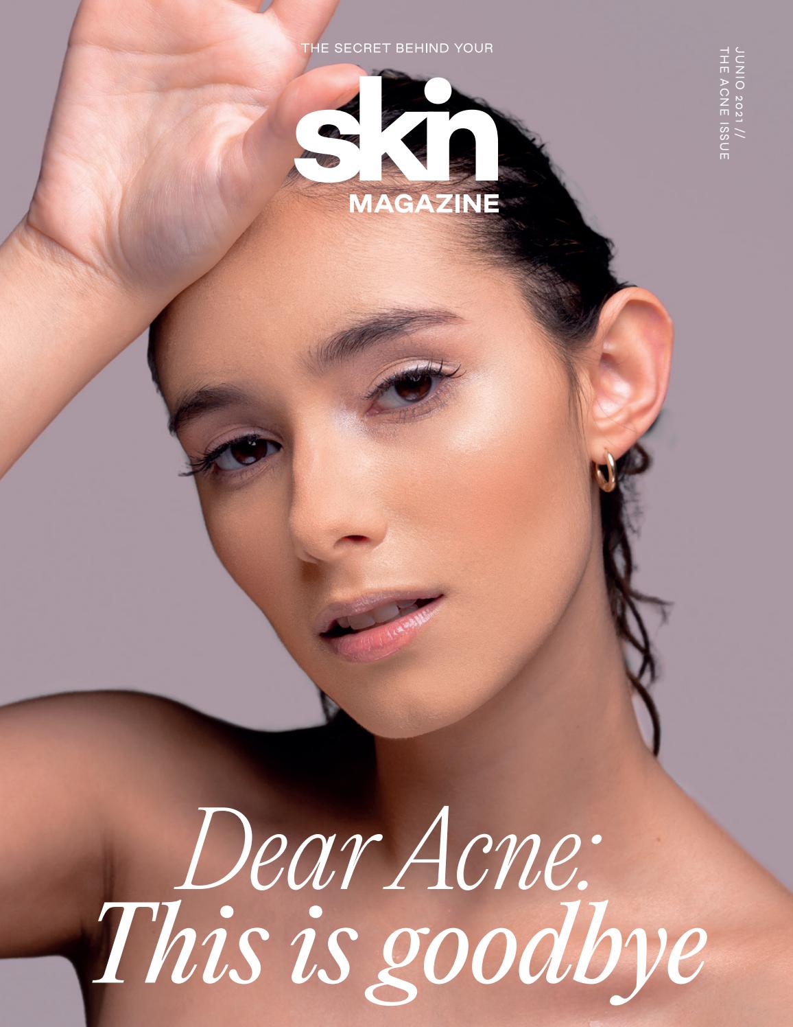 SkinMagazine - The Acne Issue. No.2 by adminSMGT - Issuu