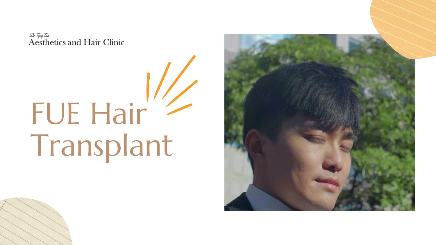What is Follicular Unit Extraction (FUE)? [PDF] by Dr Tyng Tan ...