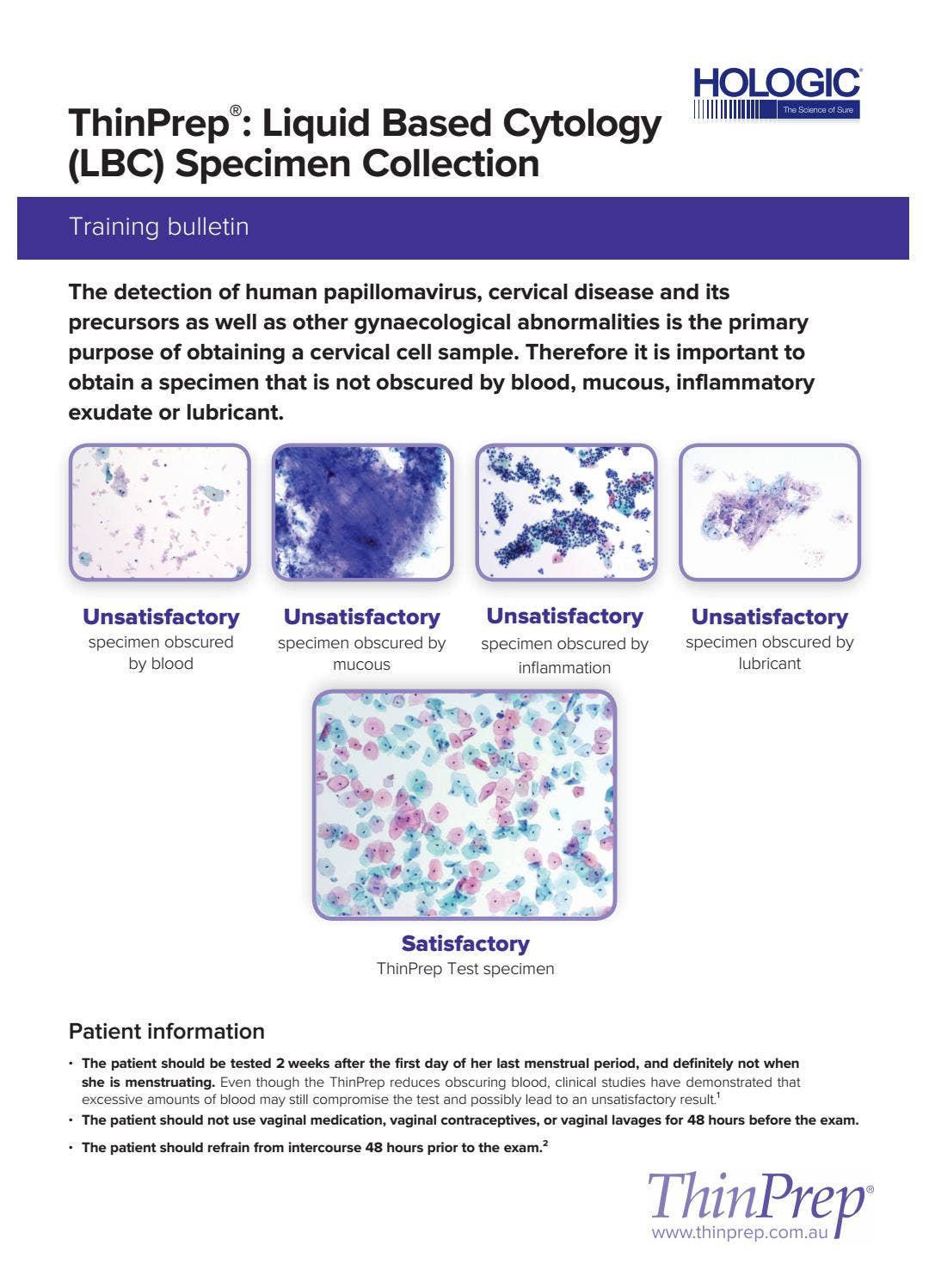 ThinPrep Liquid Based Cytology (LBC) Specimen Collection by Victorian ...