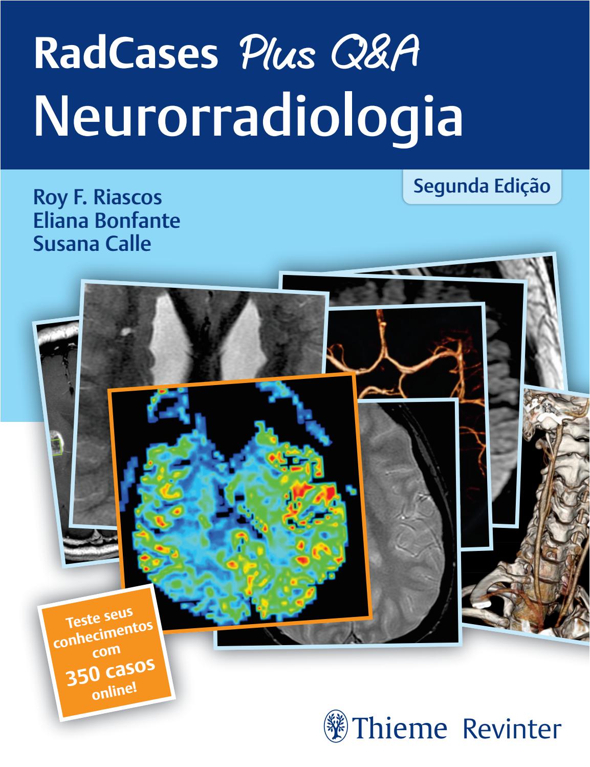 RadCases Plus Q&A Neurorradiologia by Thieme Revinter - Issuu