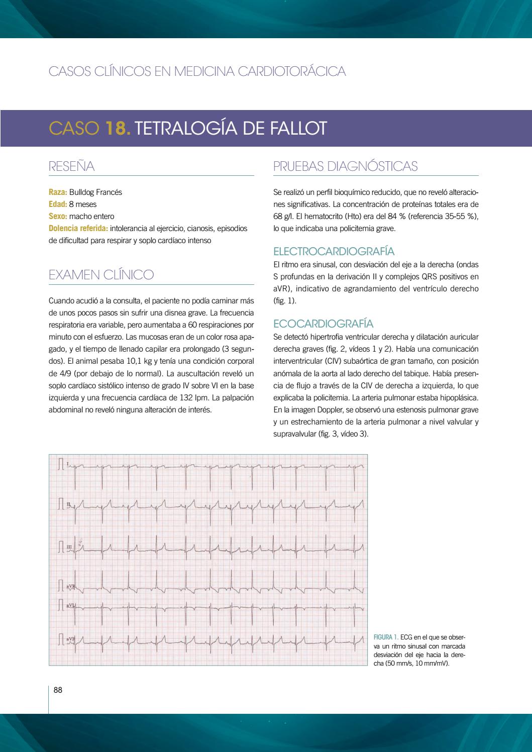 Casos clinicos en medicina cardiotorácica by Grupo Asís - Issuu