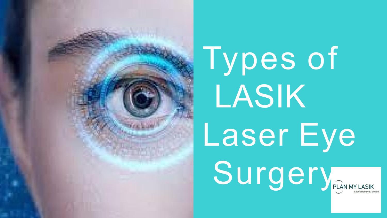 Types of Lasik Laser Eye Surgery by planmylasik - Issuu